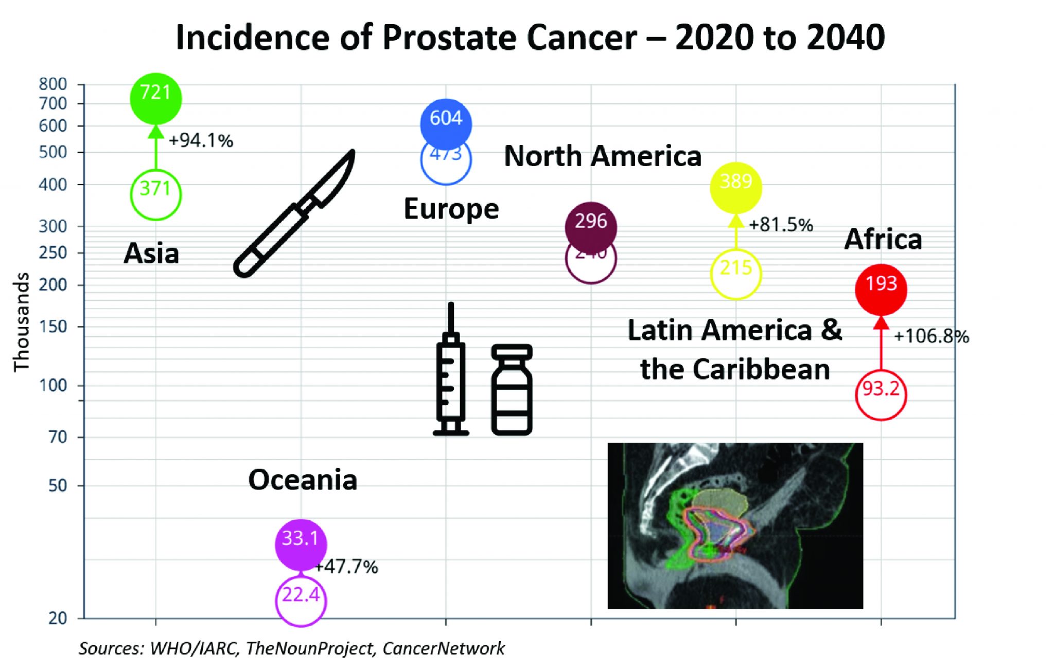 Prostate Cancer After Surgery