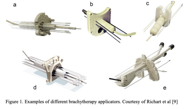 External Beam Radiation Therapy and Brachytherapy for Cervical Cancer